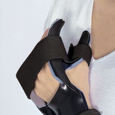Dorsal Resting Hand Orthosis – Restorative Care of America, Inc.