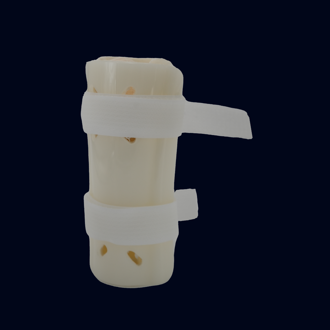 Pediatric Forearm Fracture Orthosis – Restorative Care of America, Inc.