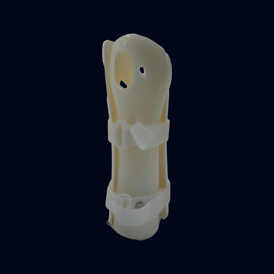 Pediatric Wrist Fracture Orthosis – Restorative Care of America, Inc.